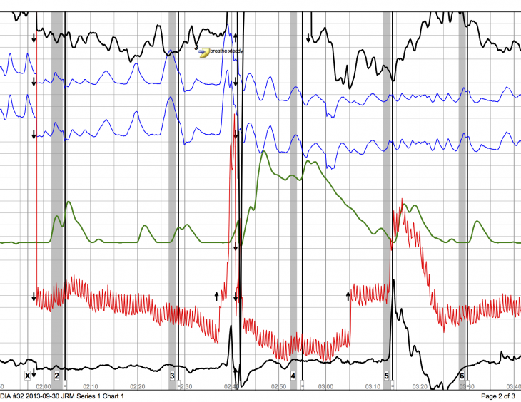 Leaked Documents Point to DIA’s Inability to Detect Sophisticated ...