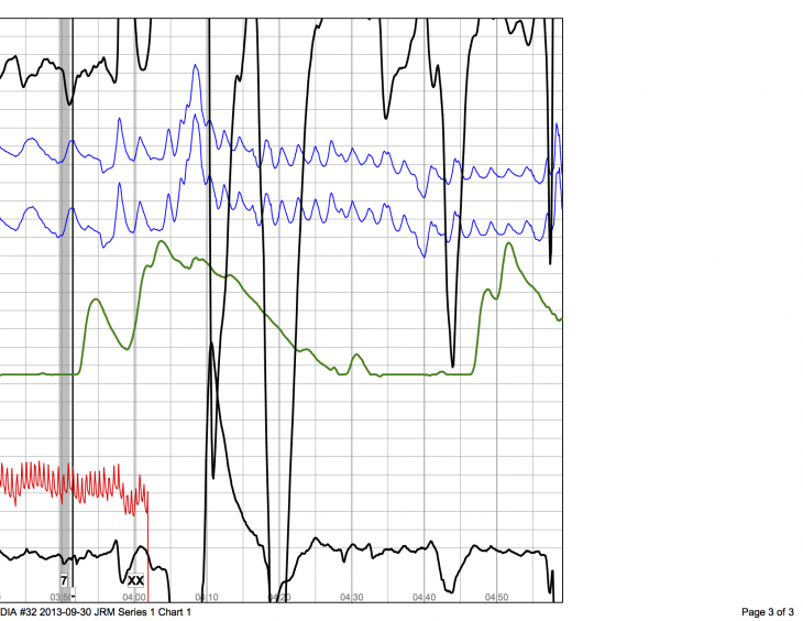 Leaked Documents Point to DIA’s Inability to Detect Sophisticated ...
