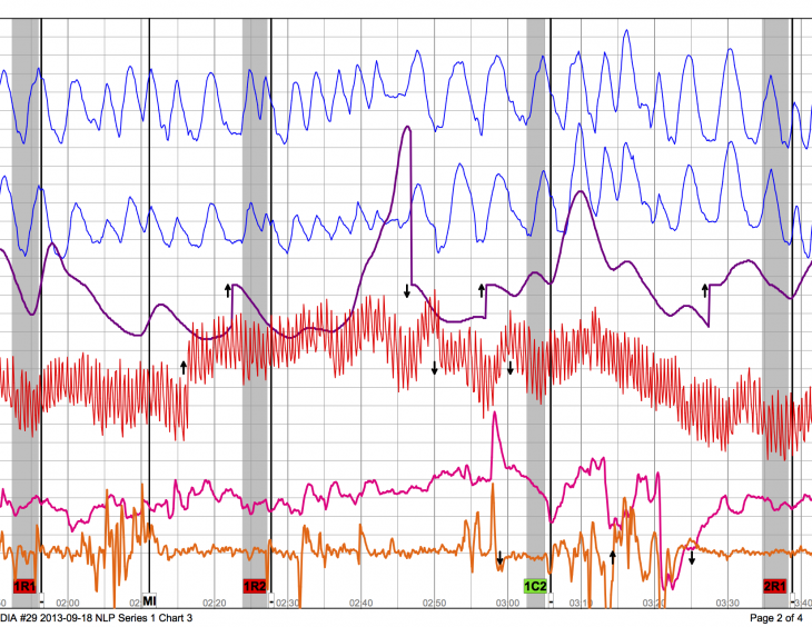 Leaked Documents Point to DIA’s Inability to Detect Sophisticated ...
