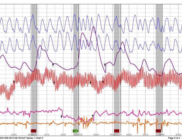 Leaked Documents Point to DIA’s Inability to Detect Sophisticated ...