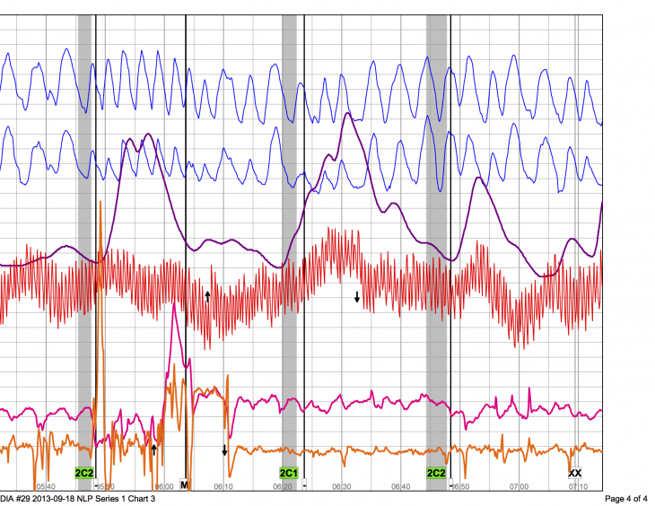 Leaked Documents Point to DIA’s Inability to Detect Sophisticated ...