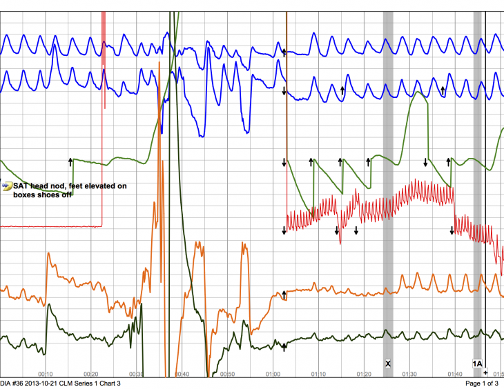 Leaked Documents Point to DIA’s Inability to Detect Sophisticated ...