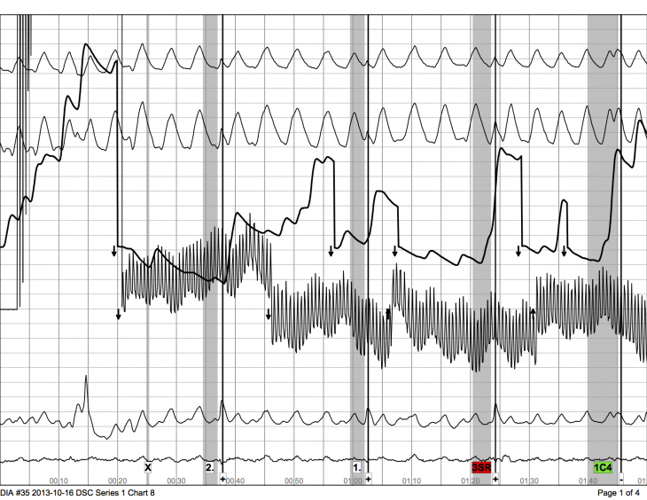 Leaked Documents Point to DIA’s Inability to Detect Sophisticated ...