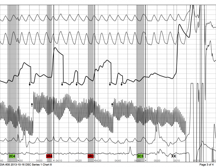 Leaked Documents Point to DIA’s Inability to Detect Sophisticated ...
