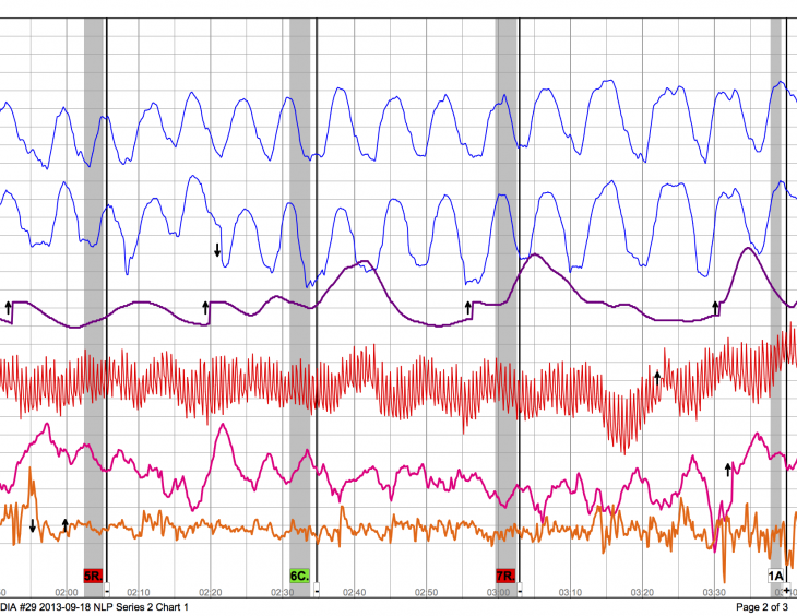 Leaked Documents Point to DIA’s Inability to Detect Sophisticated ...