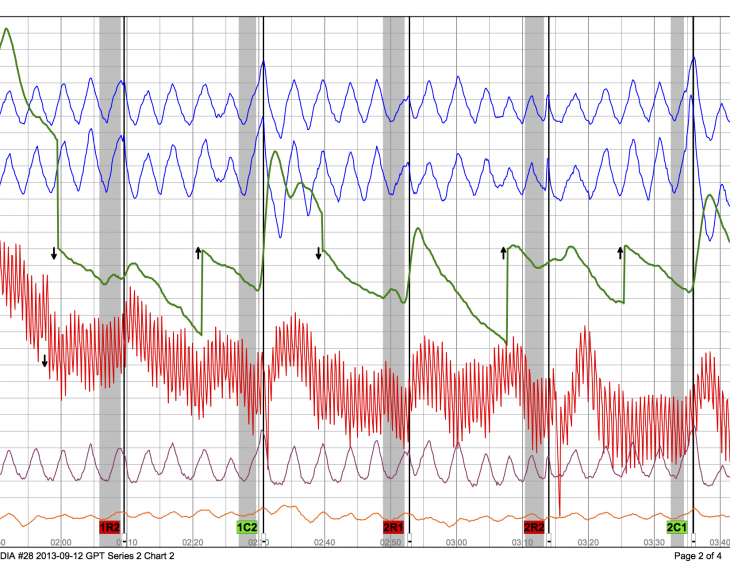 Leaked Documents Point to DIA’s Inability to Detect Sophisticated ...