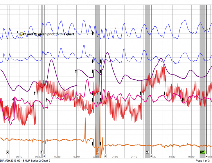 Leaked Documents Point to DIA’s Inability to Detect Sophisticated ...