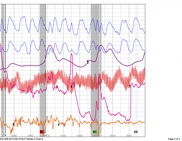 Leaked Documents Point to DIA’s Inability to Detect Sophisticated ...