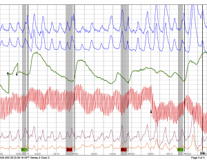 Leaked Documents Point to DIA’s Inability to Detect Sophisticated ...