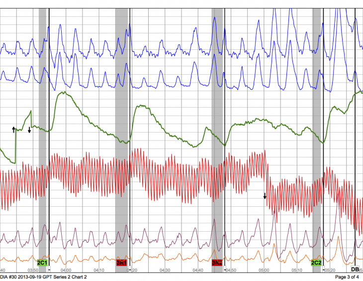 Leaked Documents Point to DIA’s Inability to Detect Sophisticated ...