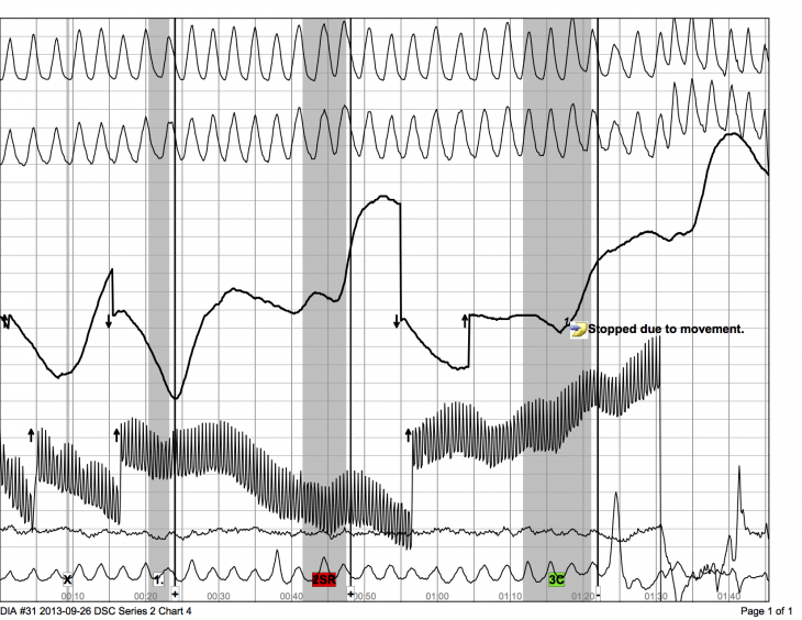 Leaked Documents Point to DIA’s Inability to Detect Sophisticated ...