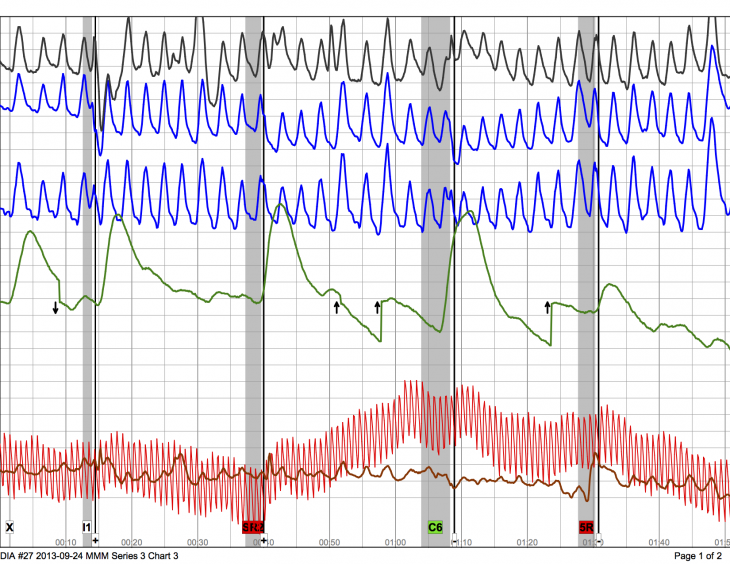 Leaked Documents Point to DIA’s Inability to Detect Sophisticated ...