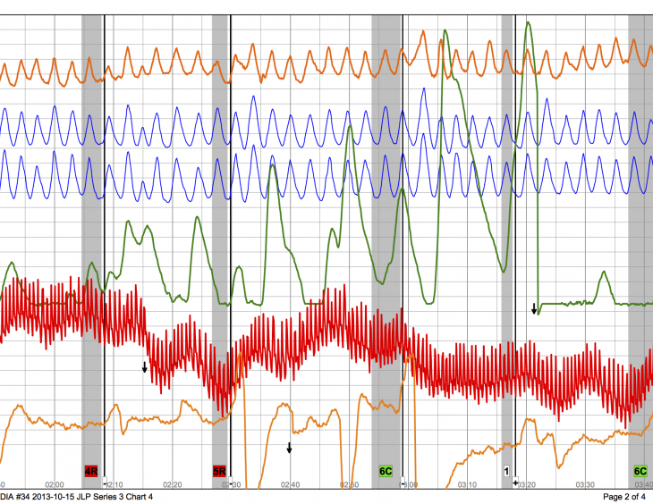 Leaked Documents Point to DIA’s Inability to Detect Sophisticated ...