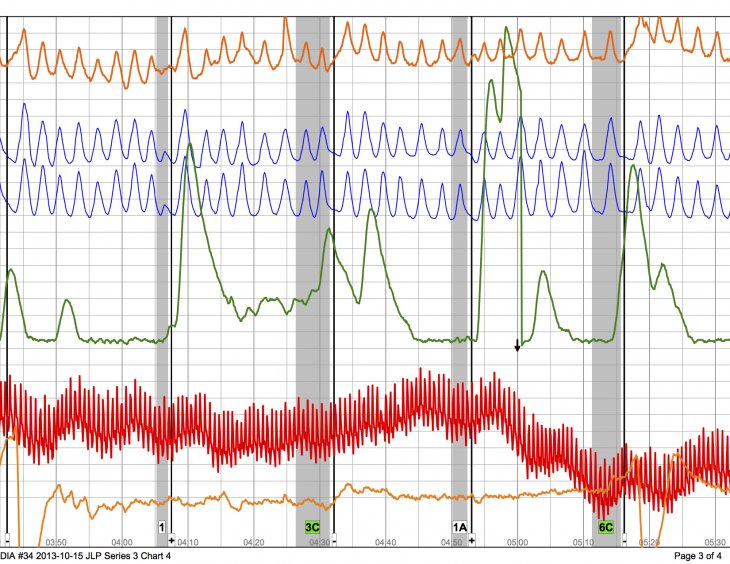 Leaked Documents Point to DIA’s Inability to Detect Sophisticated ...