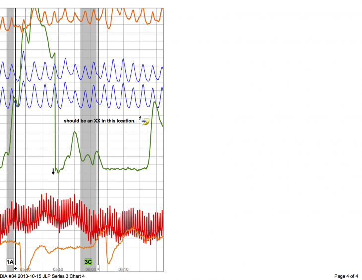 Leaked Documents Point to DIA’s Inability to Detect Sophisticated ...
