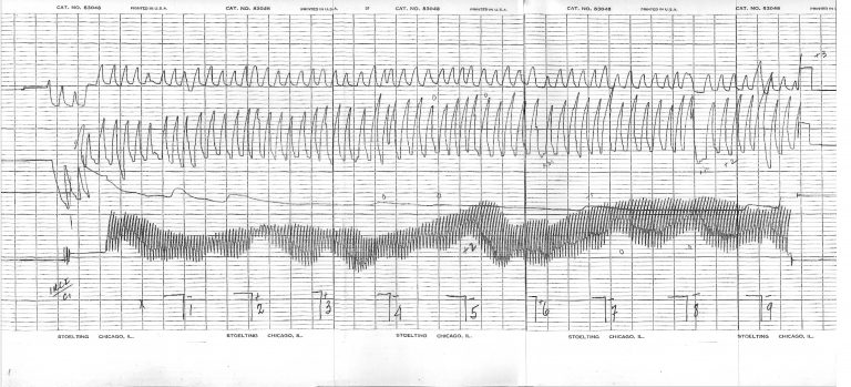 “Green River Killer” Gary Leon Ridgway’s Polygraph Charts ...